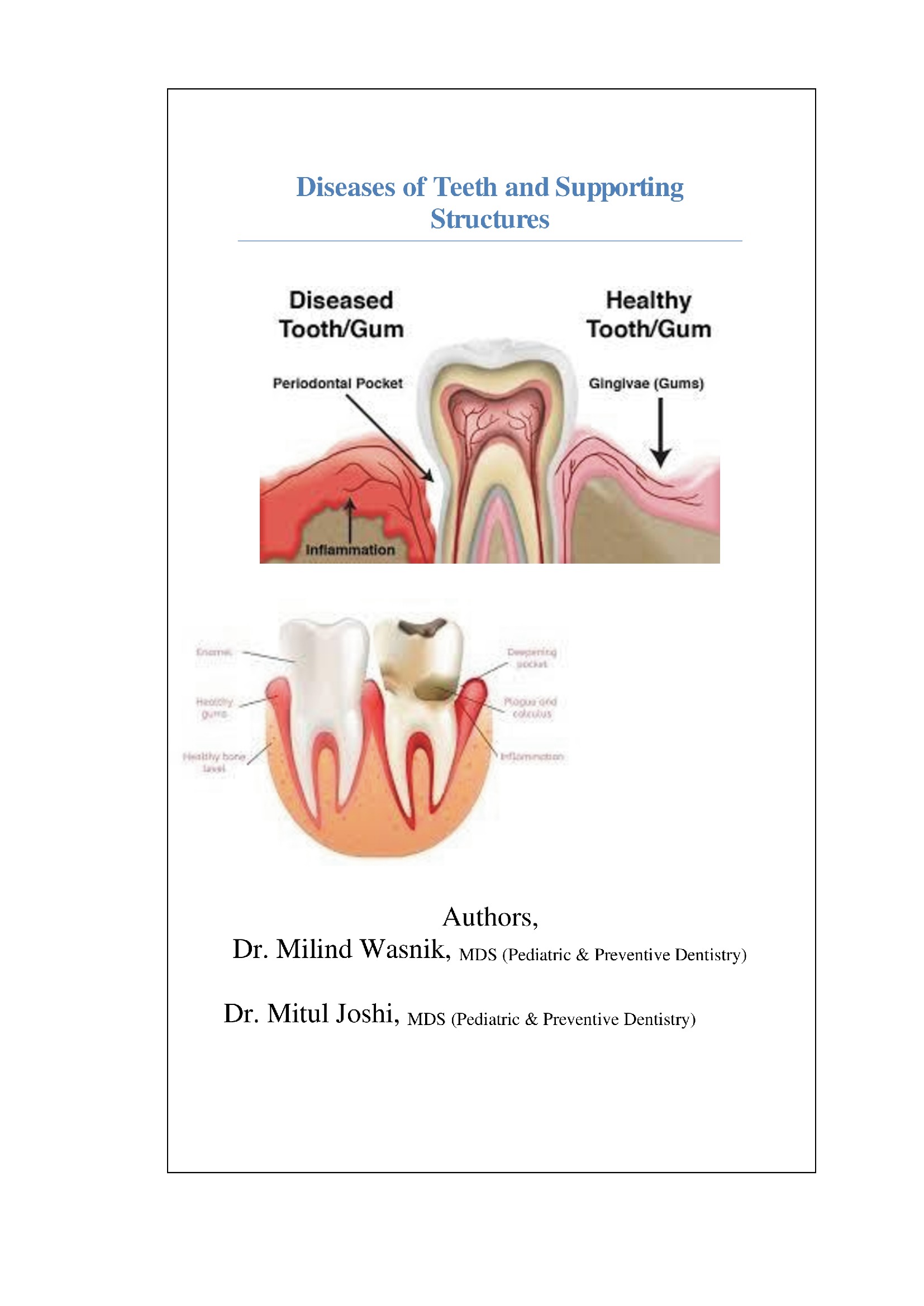 Diseases of Teeth and Supporting Structures | Pothi.com