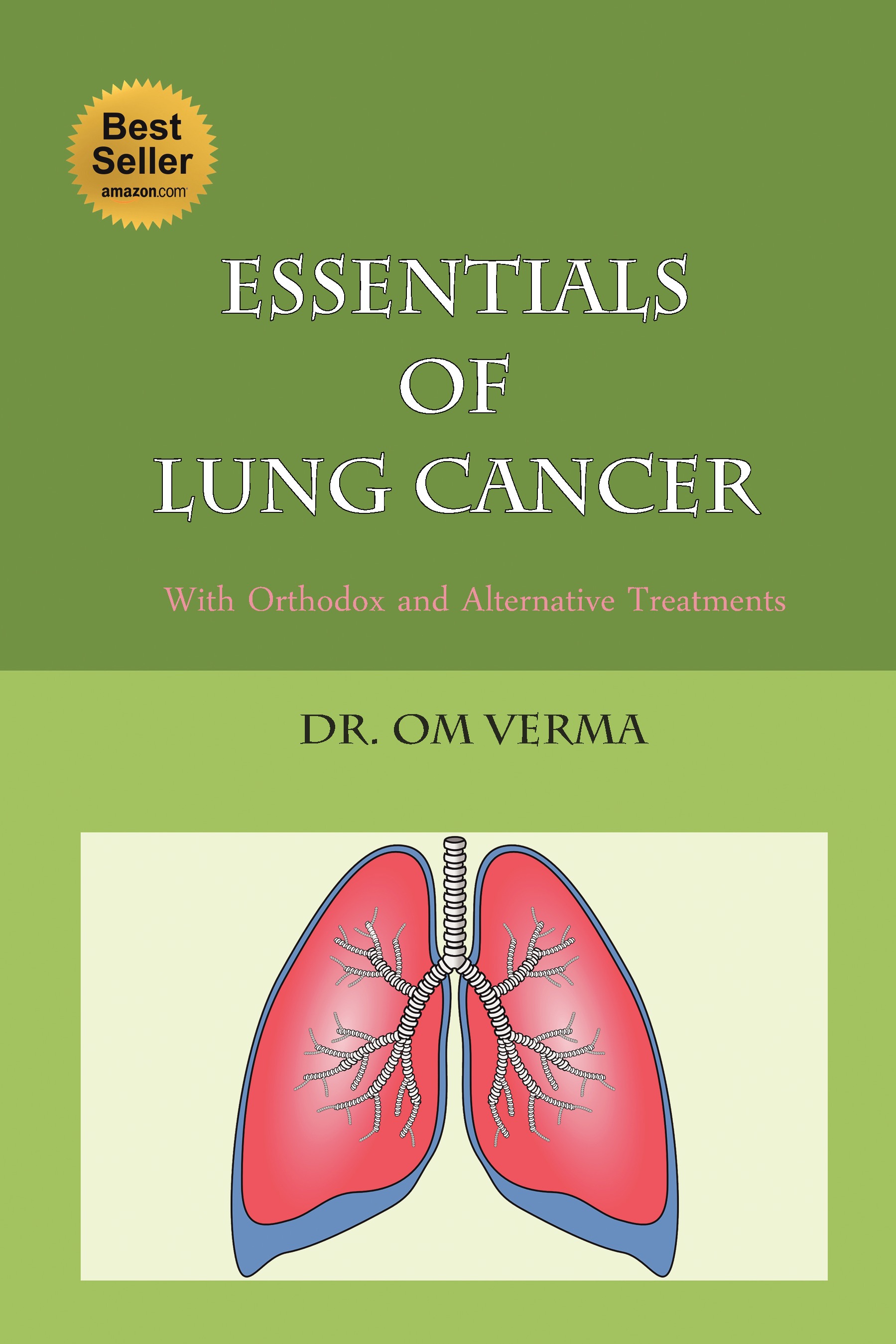 Essentials Of Lung Cancer | Pothi.com