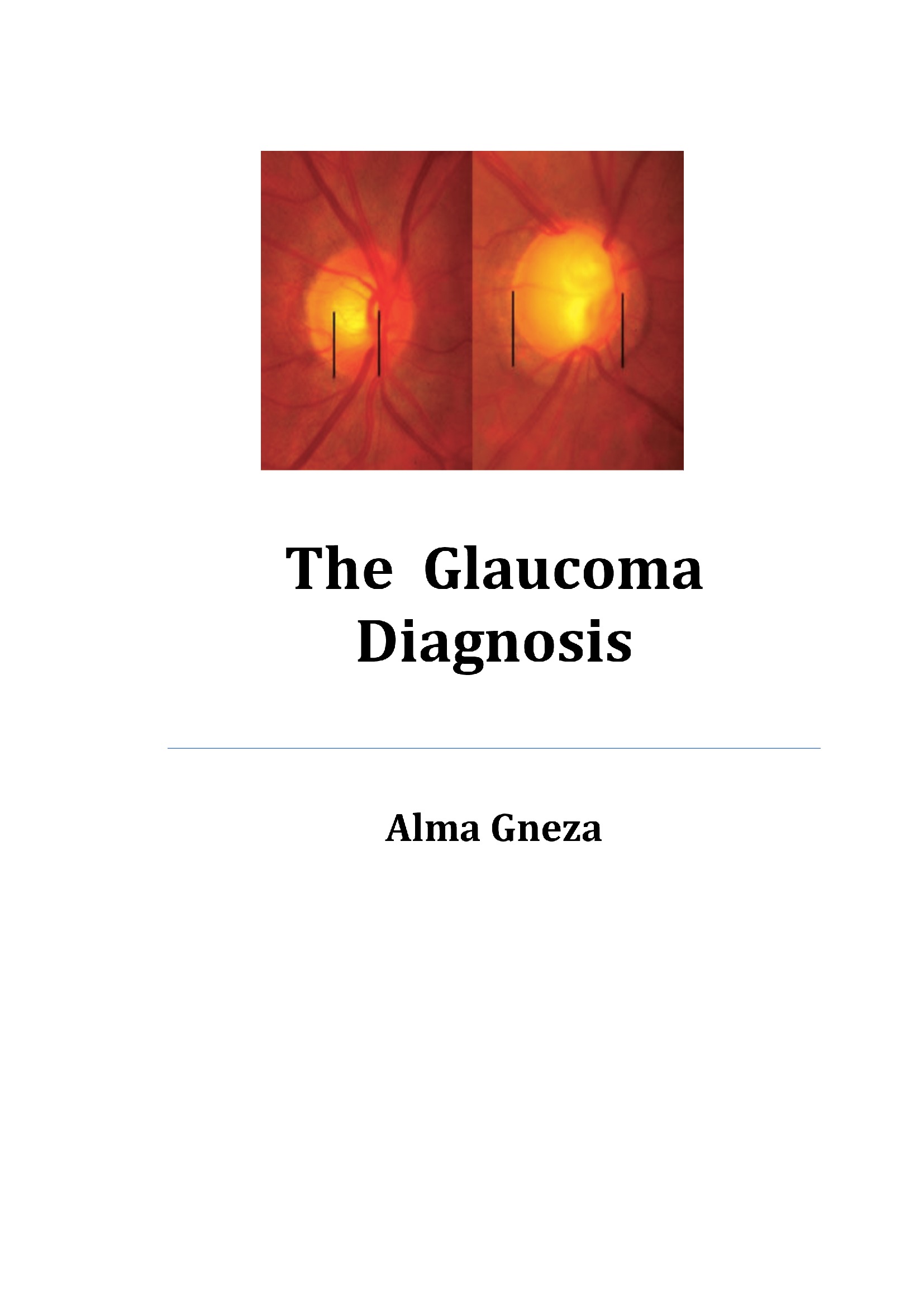 THE GLAUCOMA DIAGNOSIS | Pothi.com