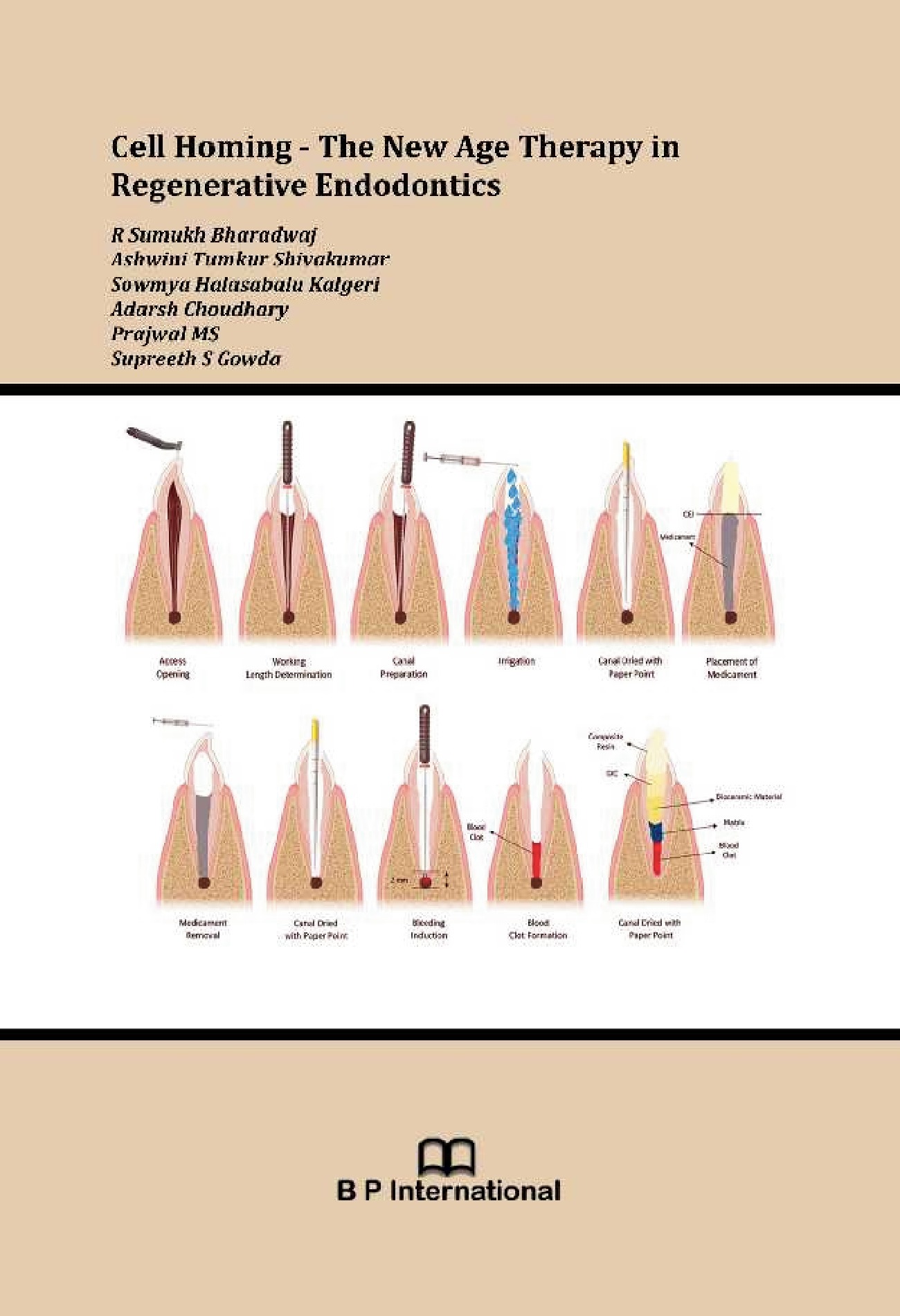 Cell Homing - The New Age Therapy in Regenerative Endodontics | Pothi.com